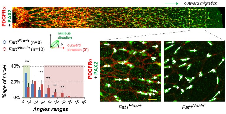 RETINAL ANGIOGENESIS